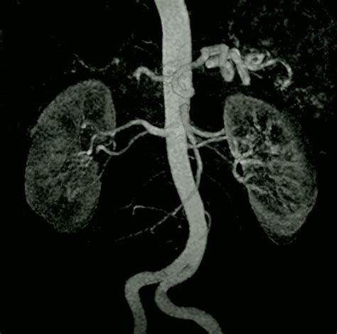 Actualite De La Medicine