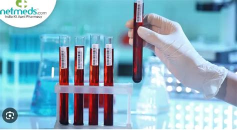 Screening Tests For Common Diseases Pakistan Observer