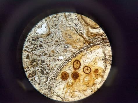Palaeomyces Gordoni Cysts Within Aglaophyton Major Members Gallery