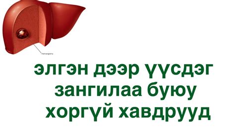 элгэн дээр үүссэн зангилаа уйланхай хэр аюултай вэ Youtube