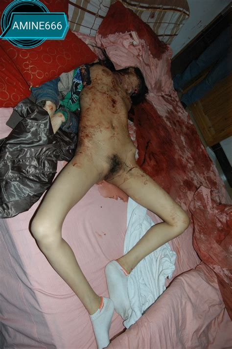 Female Execution Autopsy Pics My XXX Hot Girl