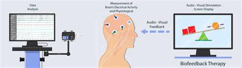 Neurofeedback Ct Neuro Therapy