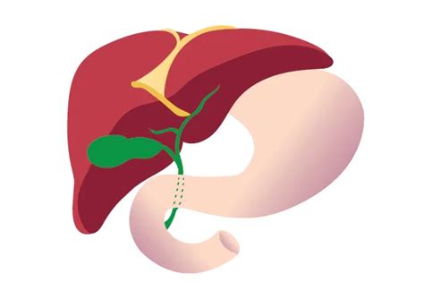 What Are Common Liver Diseases Requiring Transplant Dr Naimish Mehta