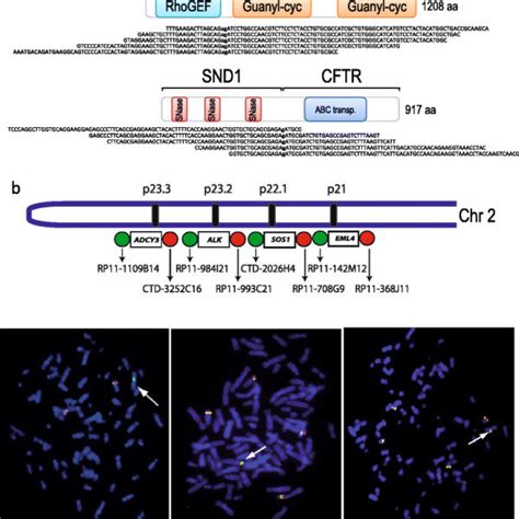 Diagram Of Fgfr2 Gene Fusions In Three Cases Of Intrahepatic