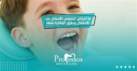 ما أعراض تسوس الأسنان عند الأطفال وطرق الوقاية منها
