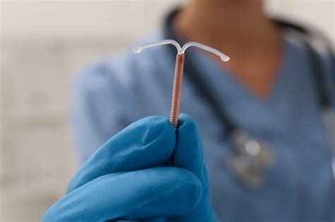 What To Expect During An Iud Placement