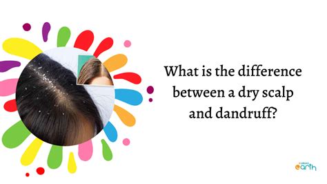What Is The Distinction Between Dandruff And A Dry Scalp