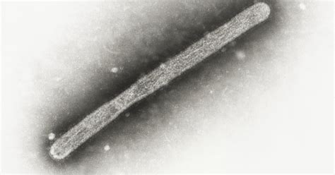 A Second Dairy Worker Has Contracted Bird Flu Cdc Reports The New