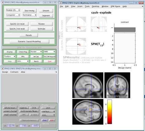 Group Analysis — Weis Menu For Neuroimage 001 Documentation