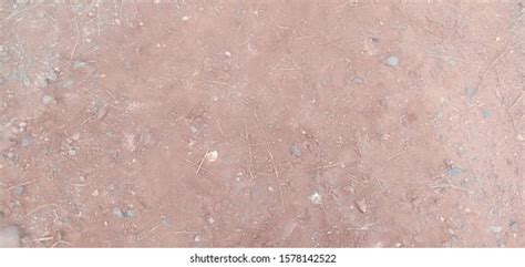 Sunburn Closeup Human Skin Flaky Skin Stock Photo 2234772067 Shutterstock