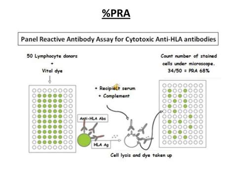 Organ Transplantation And The Hla System Lecture
