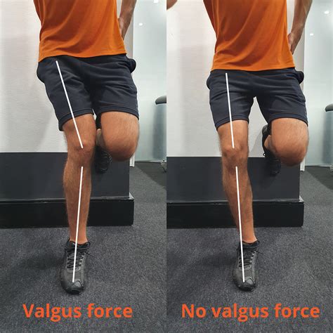 What Is Valgus Collapse Knee Valgus Explained 2021 Infinite Health