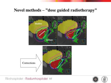 Ppt In Vivo Dosimetry Powerpoint Presentation Free Download Id9148619