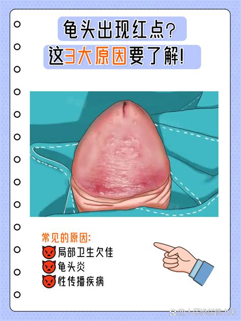 龟头出现红点？