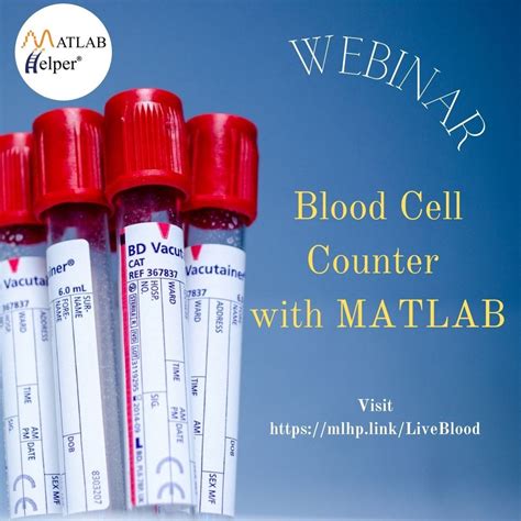 Learn The Image Segmentation Concepts To Analyze And Count Red And