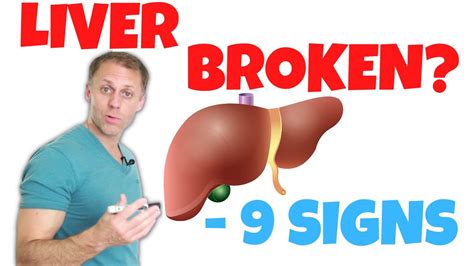 9 Signs Of Poor Liver Function YouTube