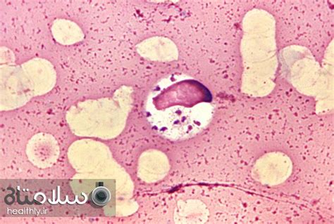 لیشمانیا ؛ عامل بیماری سالک و چندین بیماری خطرناک دیگر Kingdom Fungi