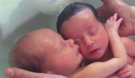 Video Captures Unbreakable Bond Between Twins Victor Valley News