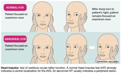 Emergency Medicine Educationposterior Circulation Strokes