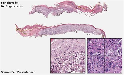 Dr Travis Brown 🎧 On Twitter Histologymicrobiology Flash Card