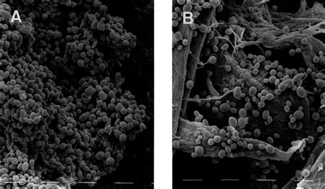 Scanning Electron Micrographs Of C Albicans Biofilms Grown For 24 H On