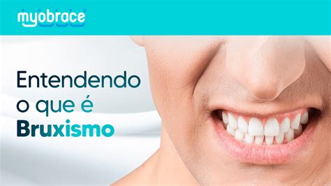 Entendendo o que é Bruxismo Apertamento dos Dentes