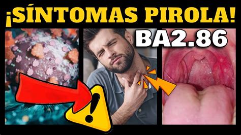 Alerta S Ntomas De Variante Pirola Variante Covid Que Avanza