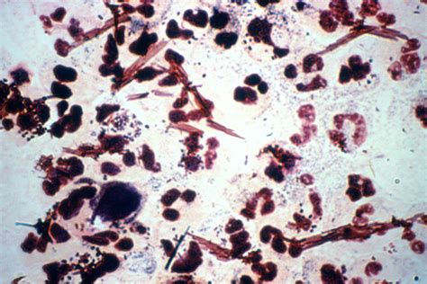 Free Picture Colorized Gram Stain Image Urethral Discharge