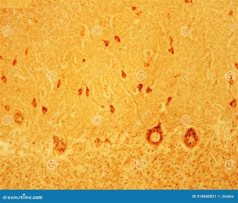 Cerebellum Purkinje Neurons Golgi Apparatus Stock Image Image Of