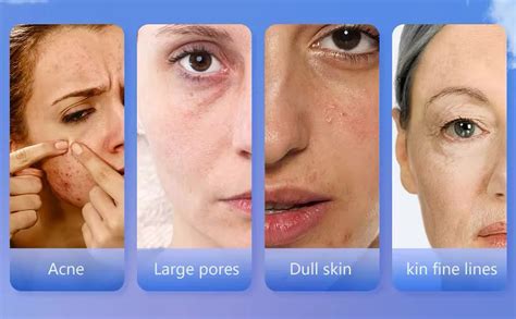 Hydration Monitorcorneometer Skin Hydration Meterskin