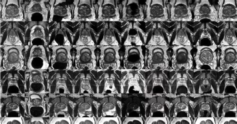의료영상 분석 정확도↑·시간비용↓” Dgist 도메인 적응 Ai 개발