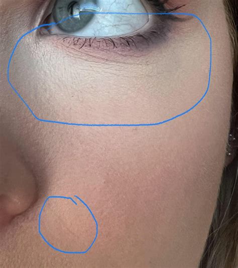 Help Creasing Under Eyes R Makeupaddiction