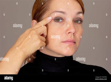 Portrait Of Cropped Caucasian Middle Aged Woman Face With Freckles