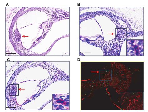 Mononuclear Cells Infiltrates In The Cochlea Of Infected Mice A Download Scientific Diagram