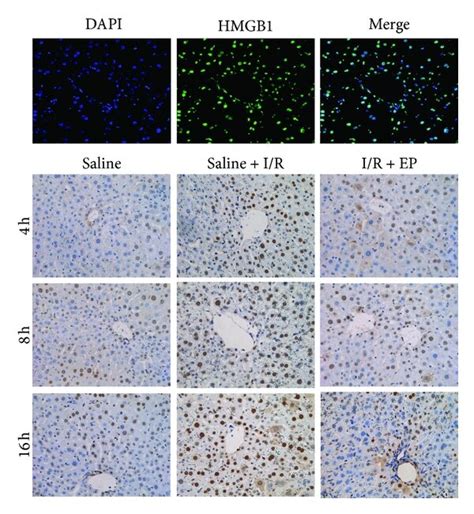 A The Expression Of Hmgb1 Tnf α And Il 6 On Cdna Level Was Detected