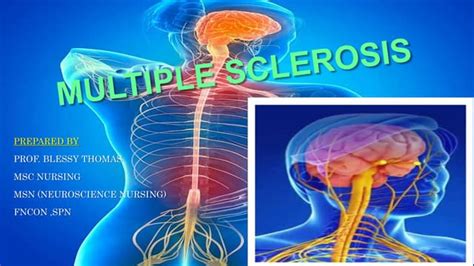 Multiple Sclerosis Ppt For Nursing Studentspptx