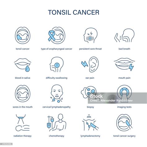 Tonsil Cancer Symptoms Diagnostic And Treatment Vector Icon Set Stock
