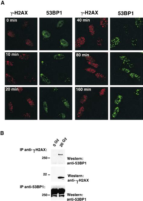 Figure 1 From Tumor Suppressor P53 Binding Protein 1 53bp1 Is