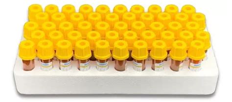 Microtubo Amarelo Gel Ativador 0 5ml Tubo De Coleta C 50 Uni MercadoLivre