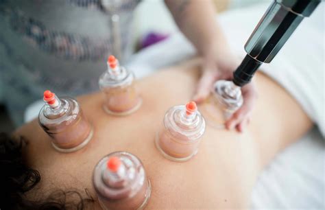 A Beginners Guide To Cupping Therapy