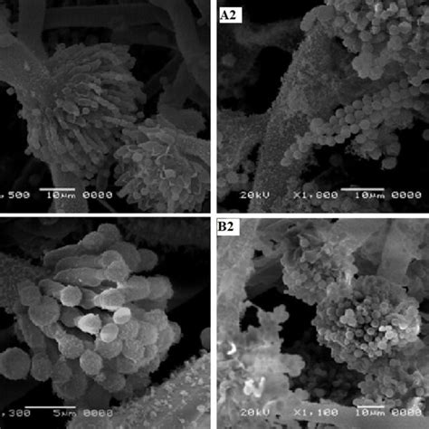 Scanning Electron Microscopy Illustrating The Pattern Of Both A