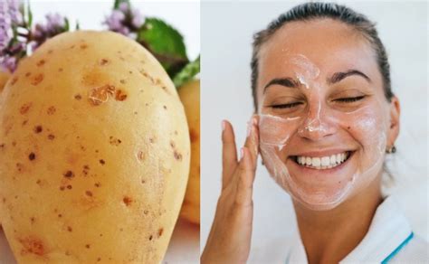 Para qué sirve la mascarilla de papa en el rostro