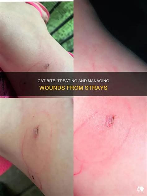 Cat Bite Treating And Managing Wounds From Strays Petshun