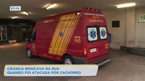 Criança foi atacada por cachorro de rua em Londrina RIC br