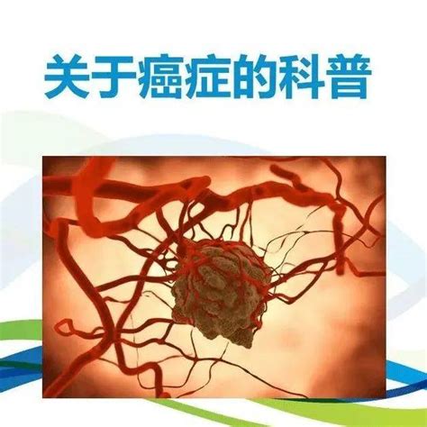 人人怕癌，做到这些也让癌怕你美国癌症协会cancer期刊