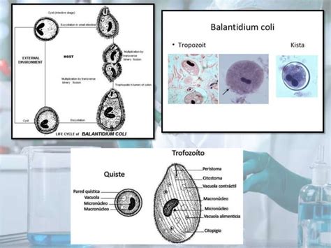 Balantidium Coli Ppt