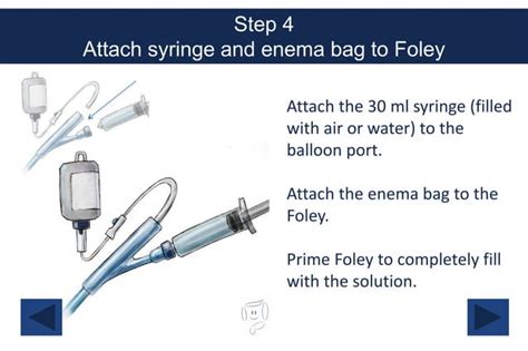 Enema Administration And Procedure Lecture Pdf