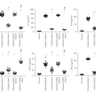 Interferon IFN γ tumor necrosis factor TNF α interleukin IL 1β