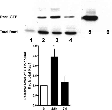 Rac1 Is Activated By Noninvasive Hair Clipping Pull Down Assays Download Scientific Diagram