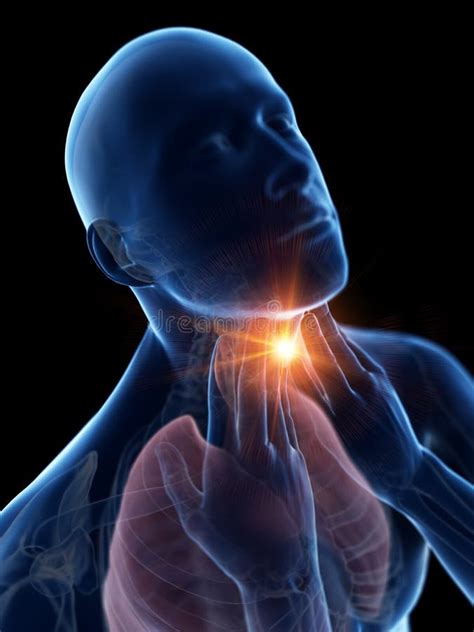 A Man Having A Sore Throat Stock Illustration Illustration Of Rendered